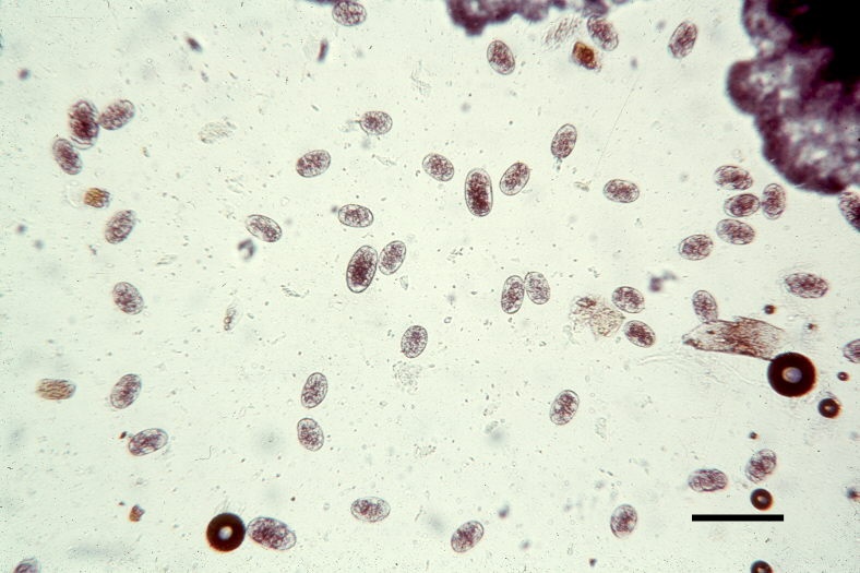 hookworm egg description